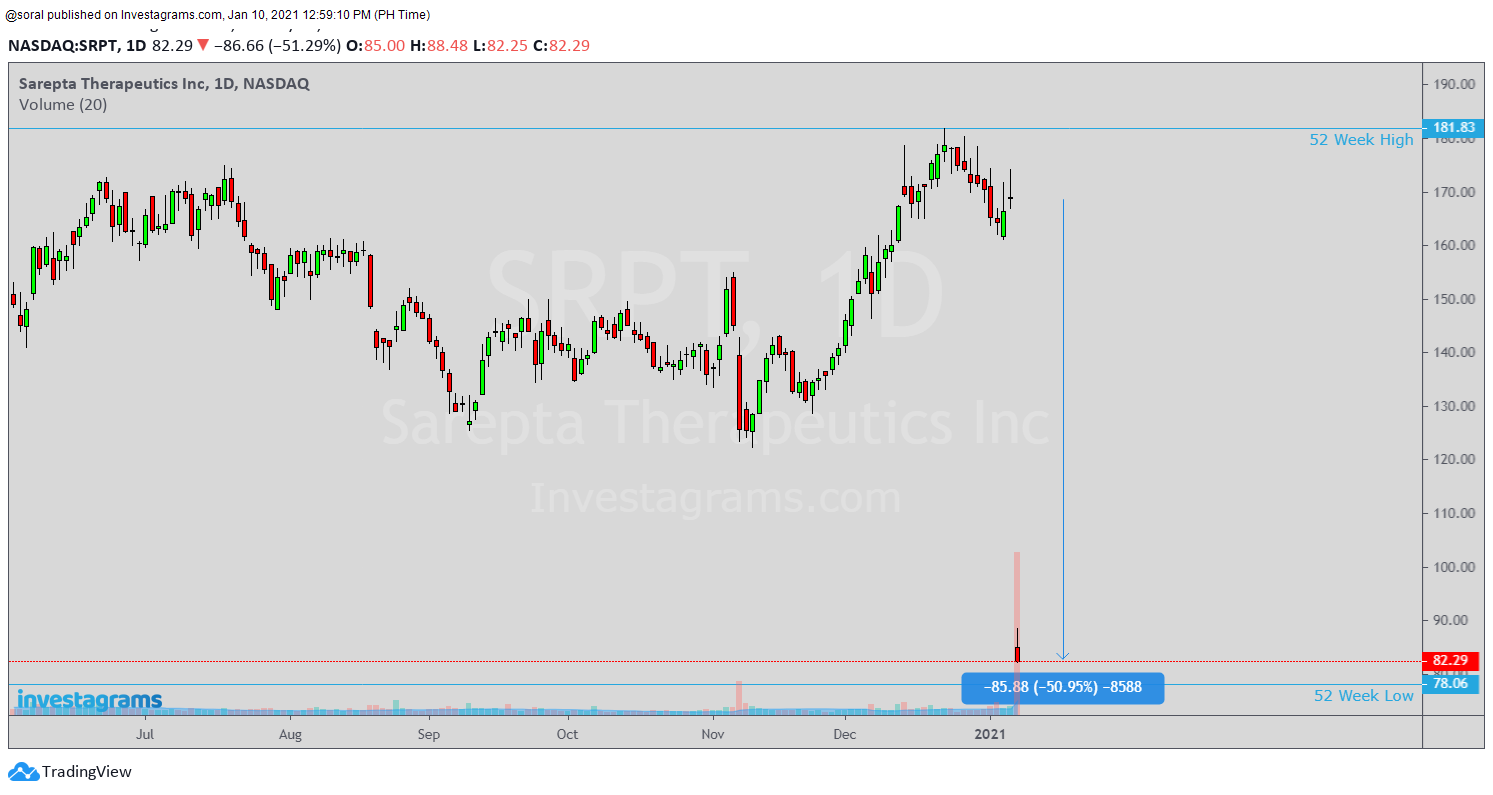 $NASDAQ:SRPT - stock trading is easy? Try the US Market and oversized your position. You will ha ...